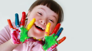 Apa Itu Down syndrome? Kenali Penyebab, Ciri-ciri, dan Pemeriksaan yang ...